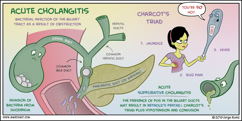 Acute Cholangitis
