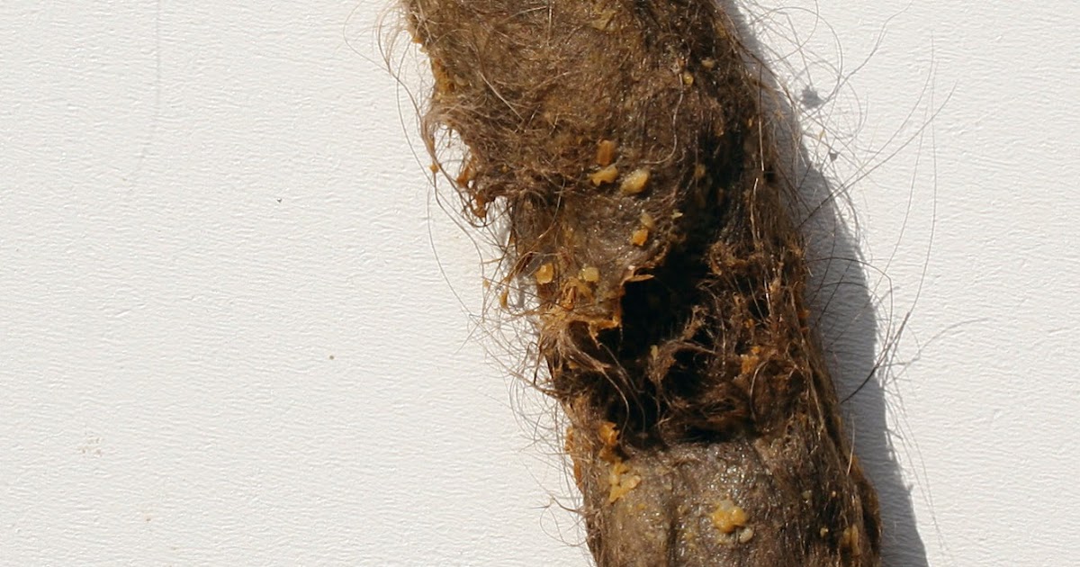 Doctors' Hub: What is Hairball or Trichobezoar?