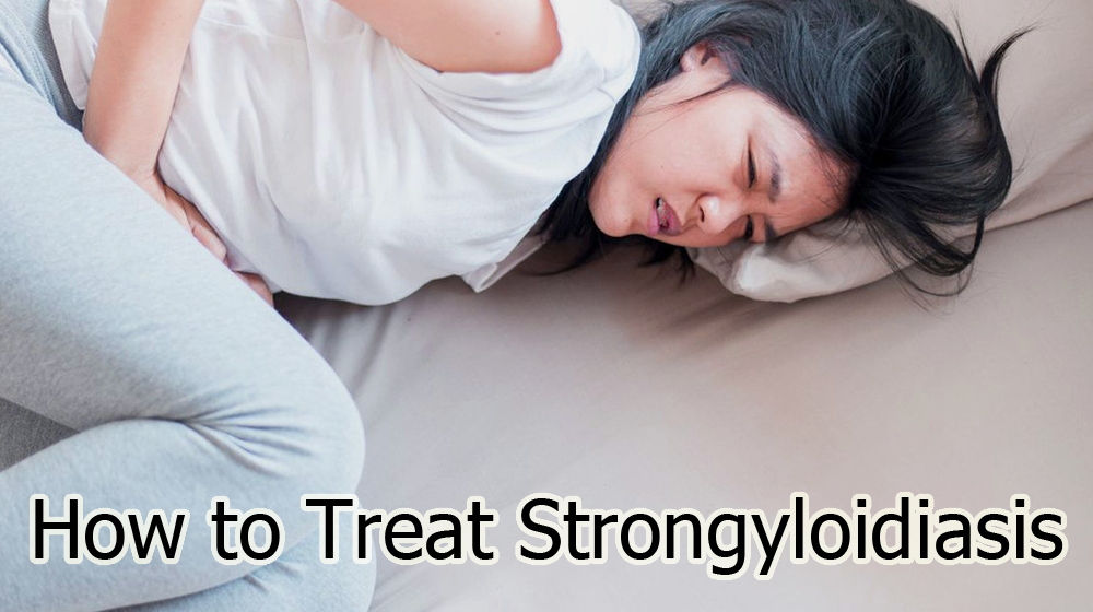 How to Treat Strongyloidiasis