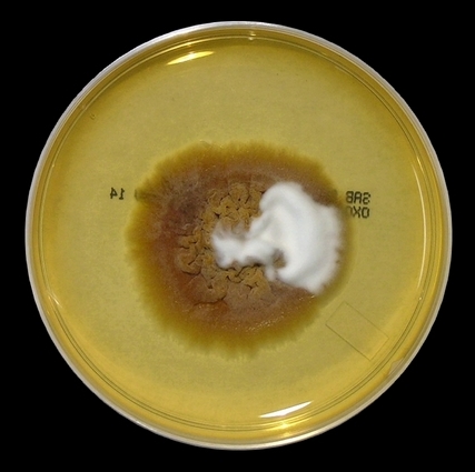 Fun With Microbiology (What's Buggin' You?): Epidermophyton floccosum