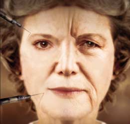 Botox Brilliant - Corinna B's World