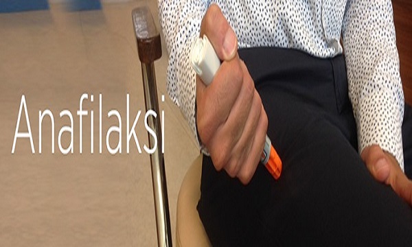 guneslerimbilgihazinesi: Anafilaksi Nedir?