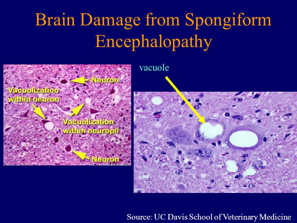 Bovine Spongiform Encephalopathy (Penyakit Sapi Gila) ~ Veterinary One