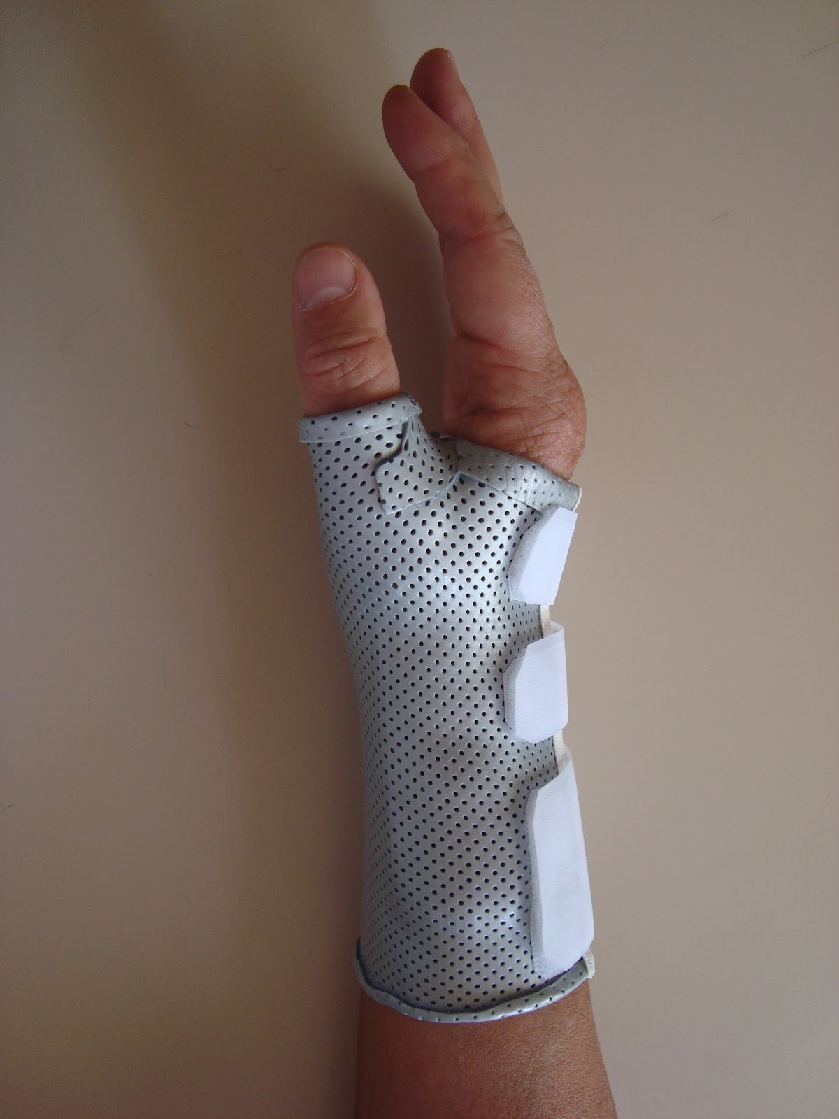 Orthèses sur mesure et appareillage personnalisé main poignet doigts ...