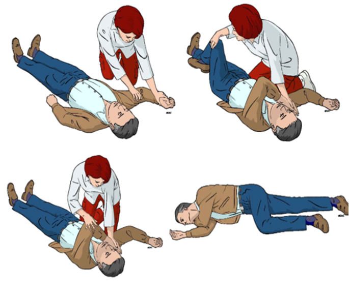 Dek Mahasiswa: Basic Life Support, Resusitasi Jantung Paru