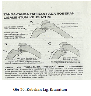 sikkahoder: DISLOKASI TULANG AKIBAT FRACTURE