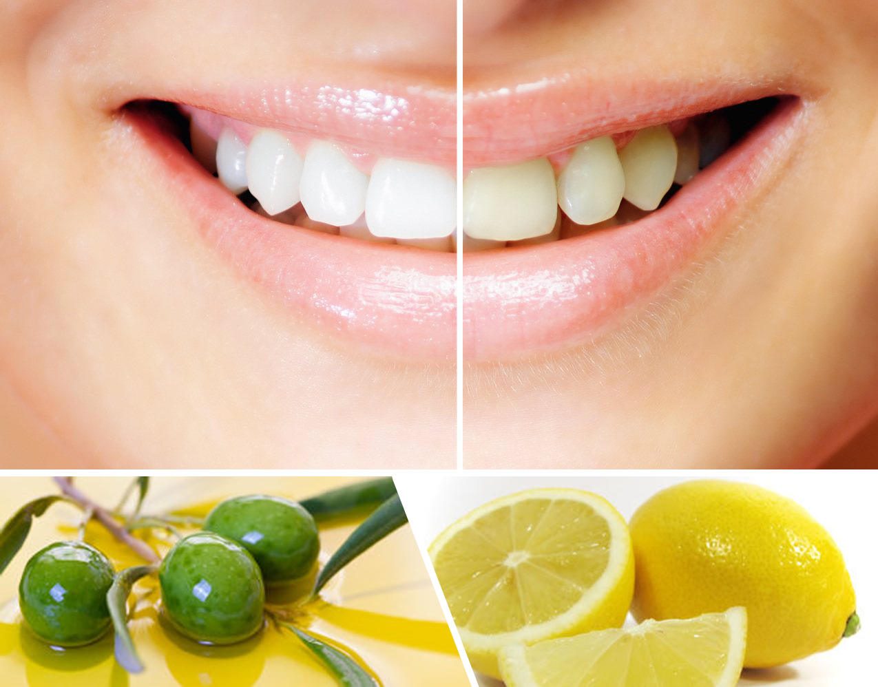 Simple yet Effective Methods on How to Get Teeth White ~ howlifehealthy