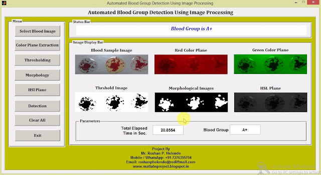 Blood Group Detection Using Image Processing Matlab Project with Source ...