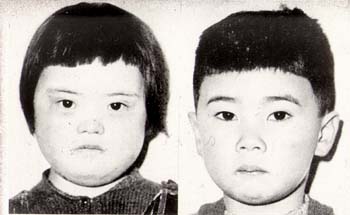 Dr.Guarionex Estrella Semiología Quirúrgica: Facies