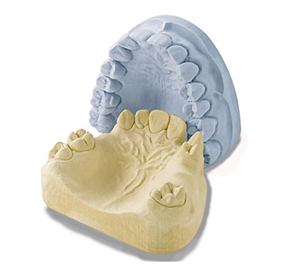 Gypsum Dental Stone Models
