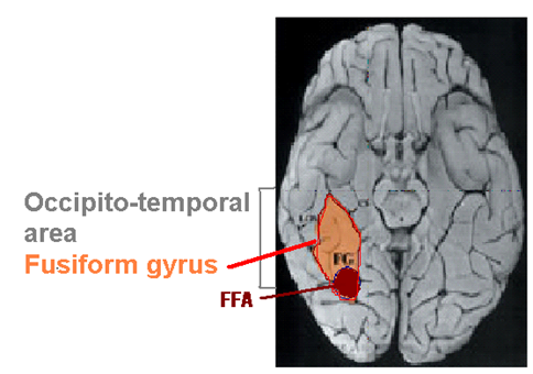 Centro de Atenção Cognitiva: O que é prosopagnosia?