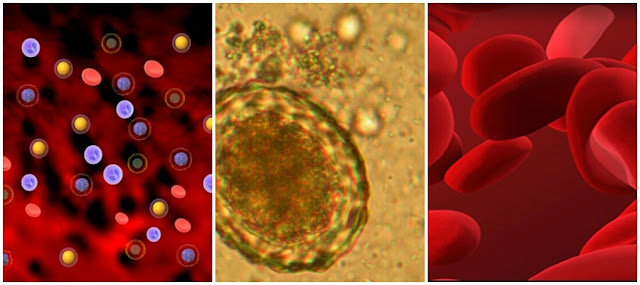 The important of Live Blood Analysis (LBA)