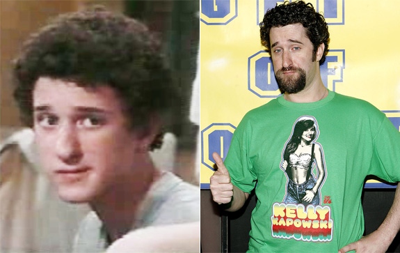 Dustin Diamond Plastic Surgery
