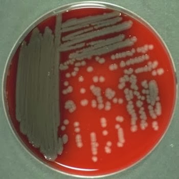 Show do Medo: SCP Foundation: SCP-532