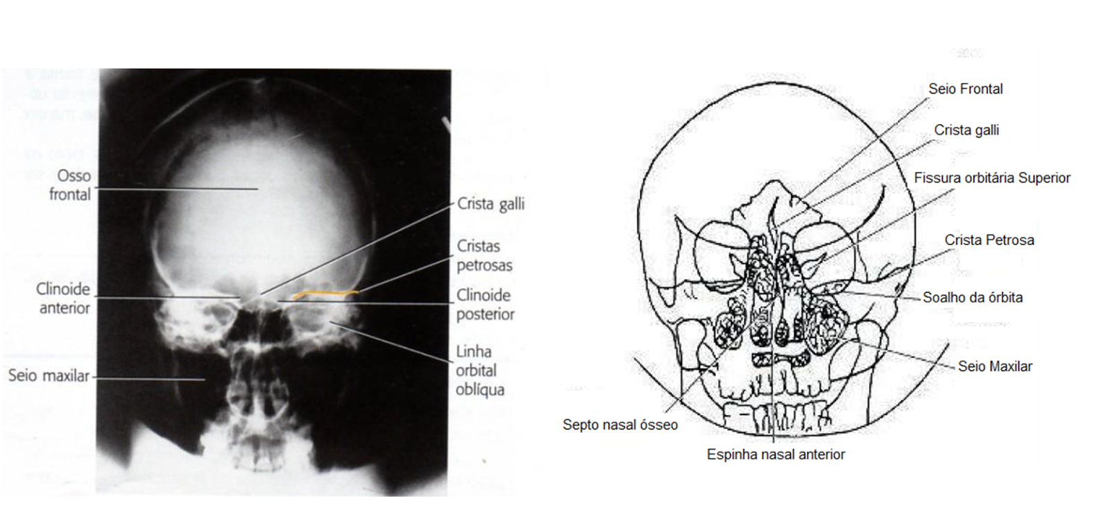 Laboratório de Roentgen: Crânio e Face