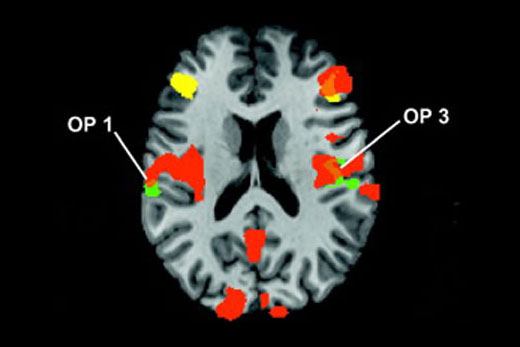 Metaphors activate sensory areas of brain | healts blogs