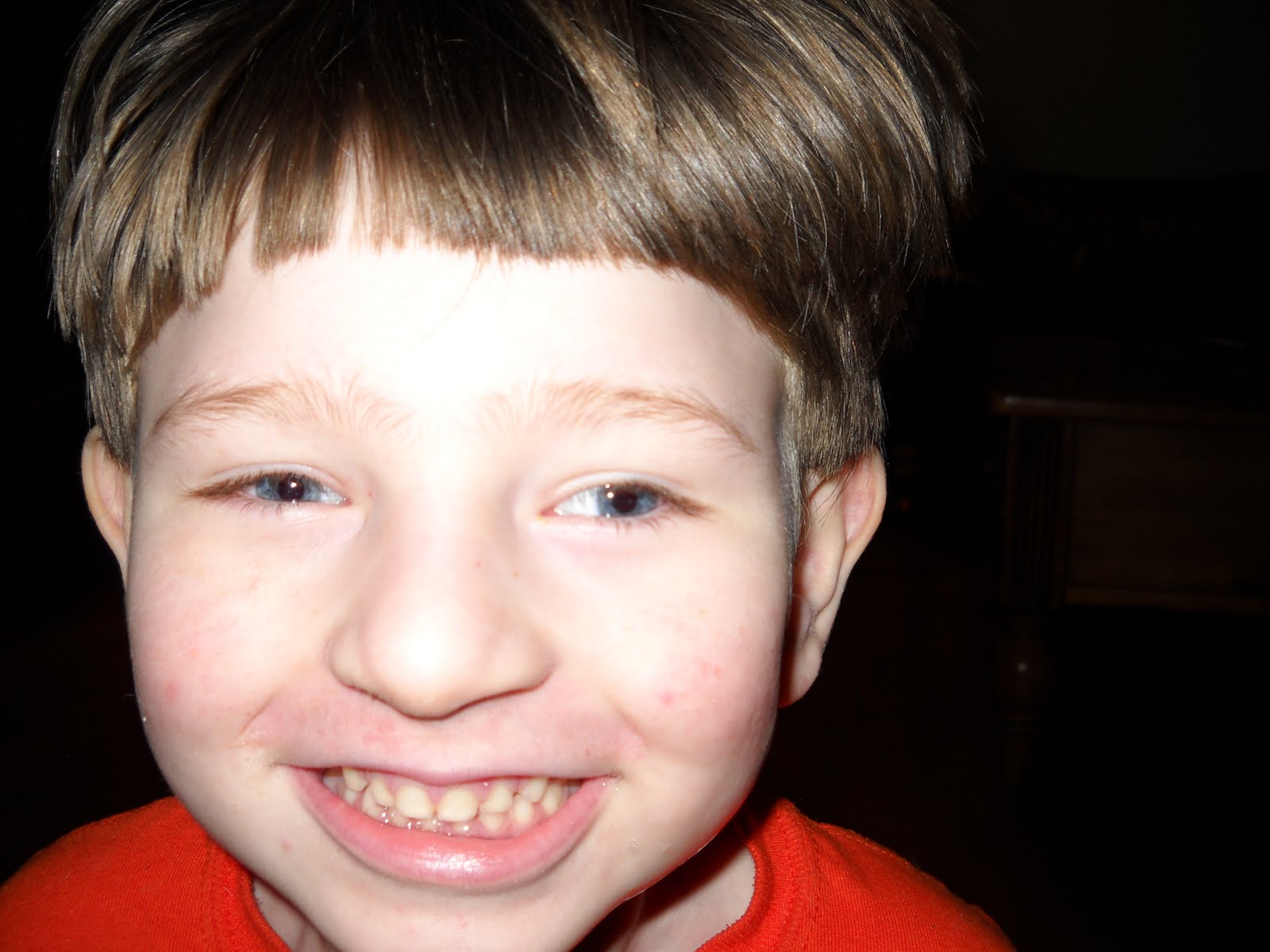 Stop Seizures Now: The Fear of Losing a Child With Angelman Syndrome