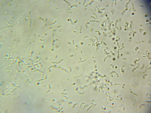 Yogurt Under Microscope