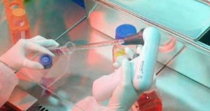 Pro-Cellule Staminali: Usa, primo paziente trattato con cellule ...