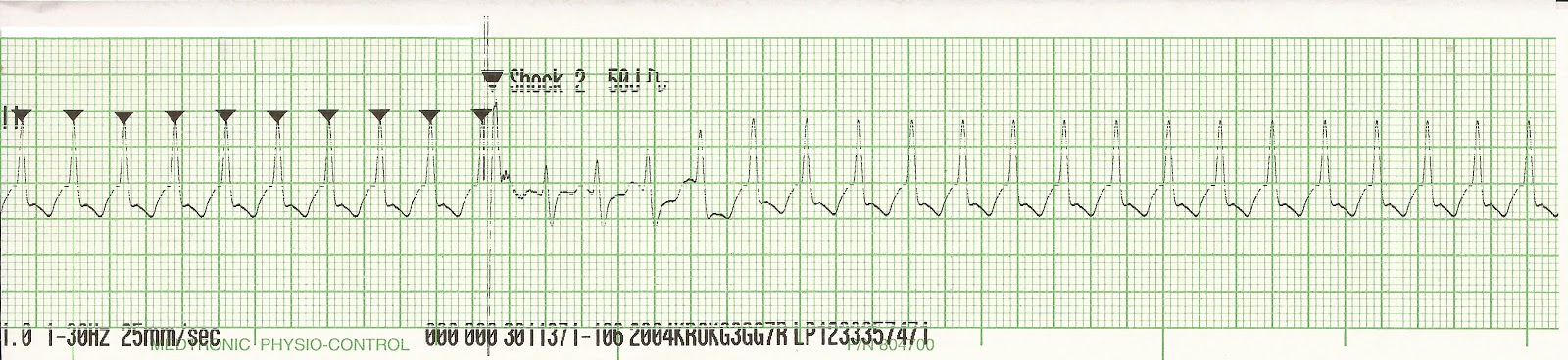 Electrical Interventions