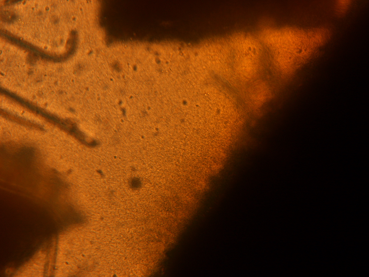 University of Illinois Plant Clinic: How We Identify Corn Leaf Diseases ...