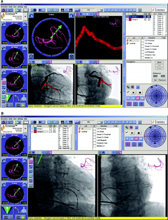 Dr Han Naung @ Henry Han : Electrophysiology and Heart Rhythm ...