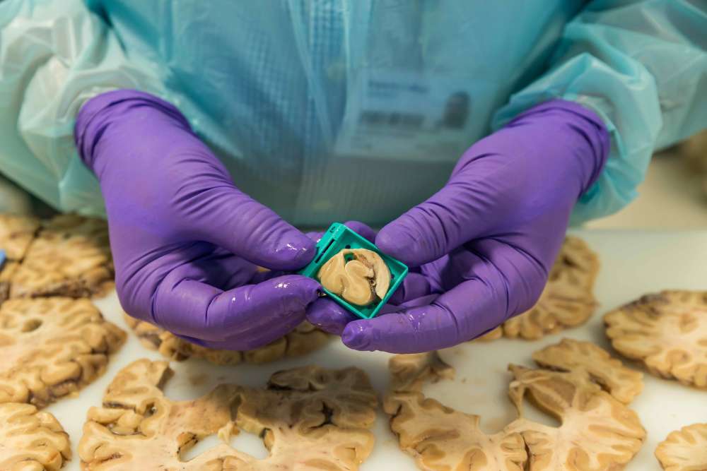 Our Parkinson's Place: This Is What Happens To Your Brain When You ...