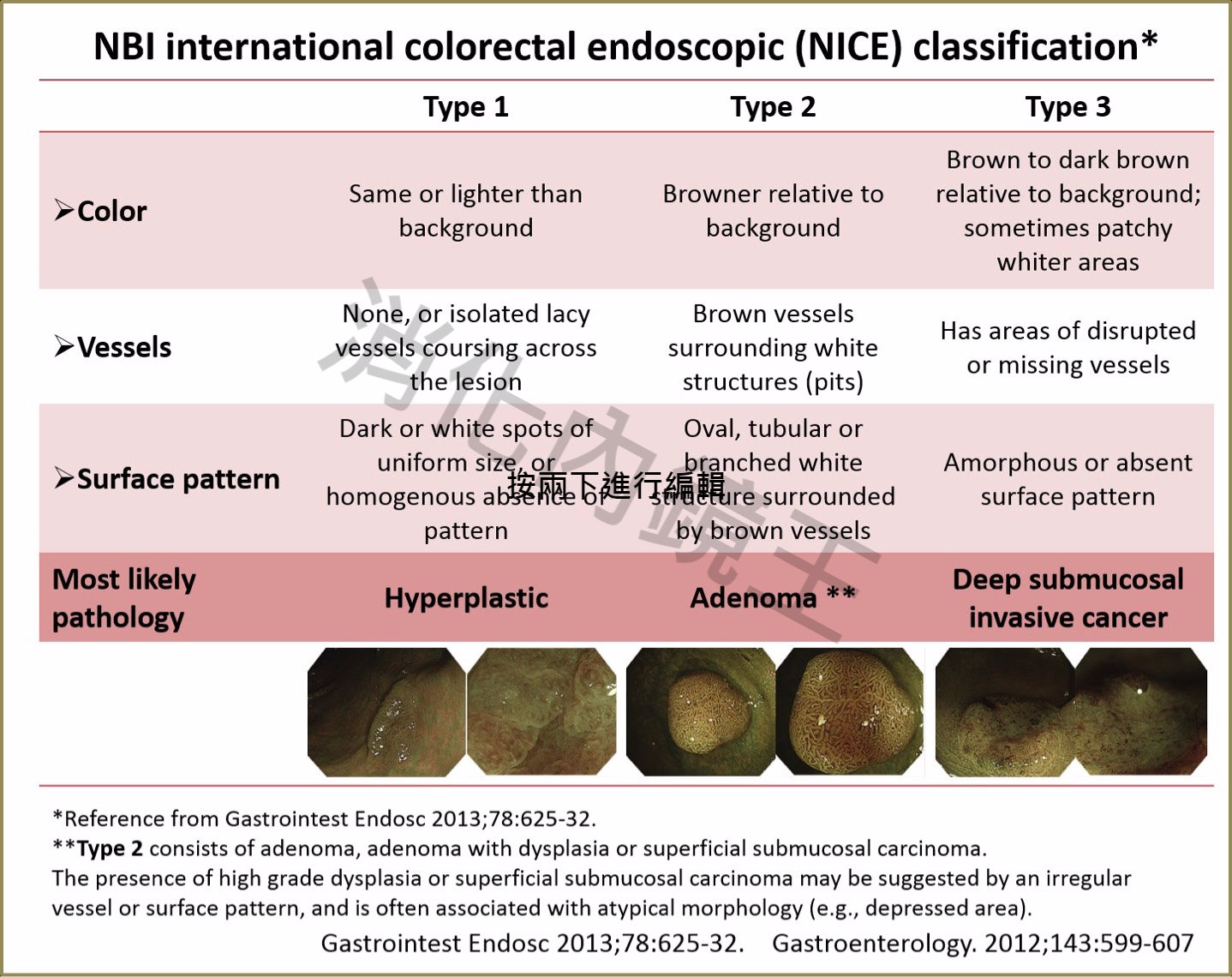 消化內鏡王 - King of digestive endoscopy : IEE在大腸的應用