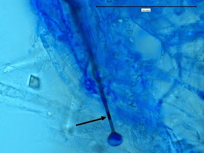 Fun With Microbiology (What's Buggin' You?): Apophysomyces elegans ...