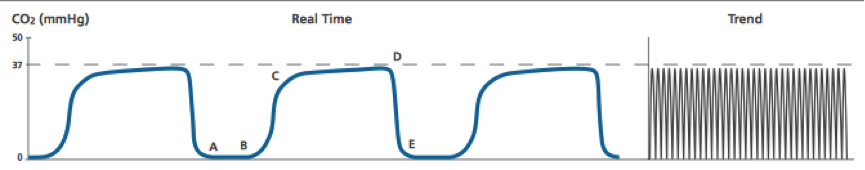 EM Didactic: Capnography beyond ROSC