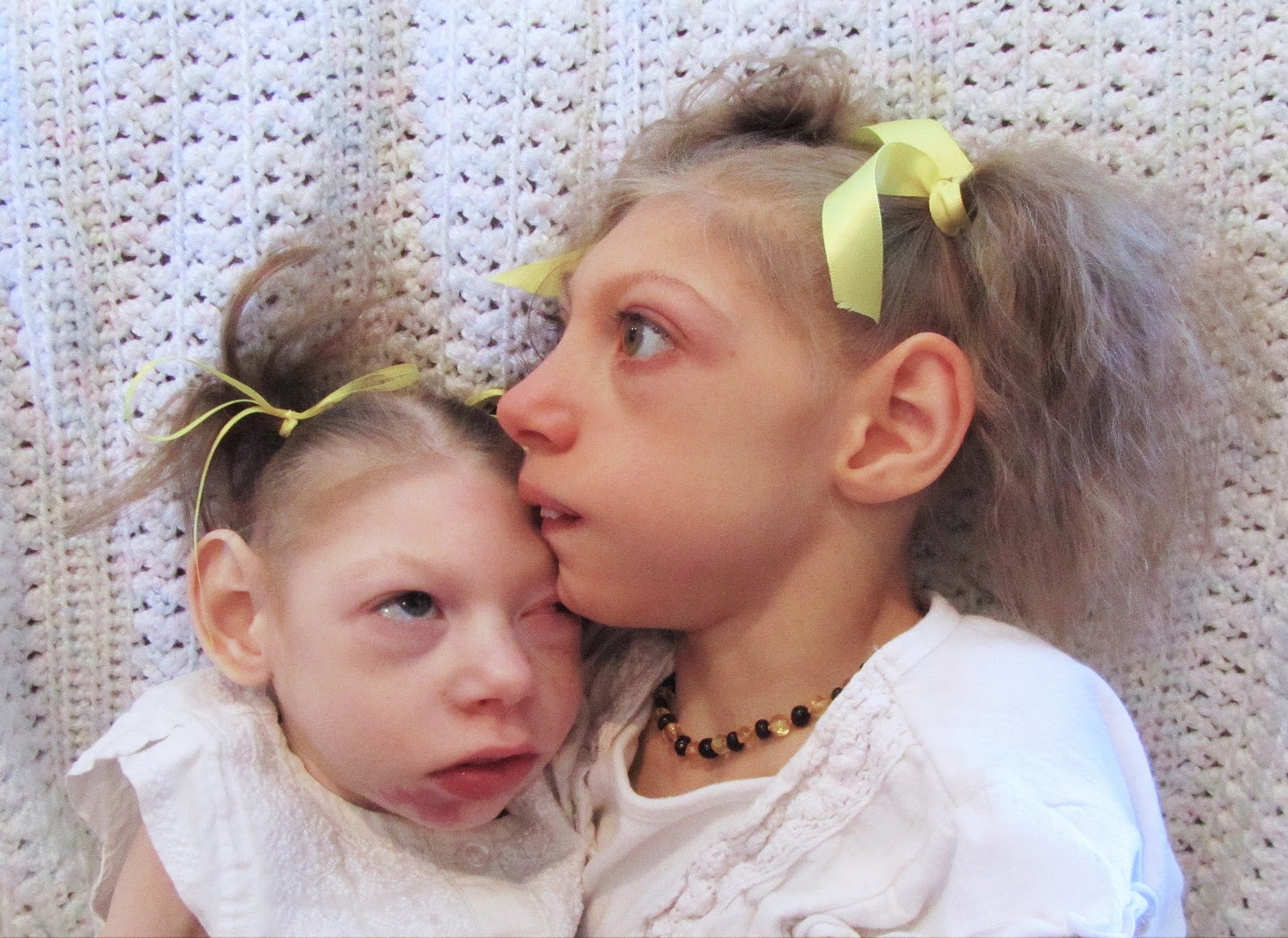 The Hartley Hooligans: Yellow