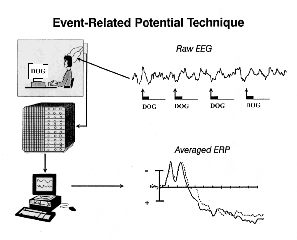 Cognitive Neuropsychology 101: Tools of the trade ! Human neuropsychology
