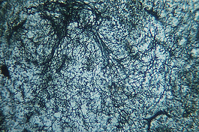 El Cuerpo Humano: tejido reticular