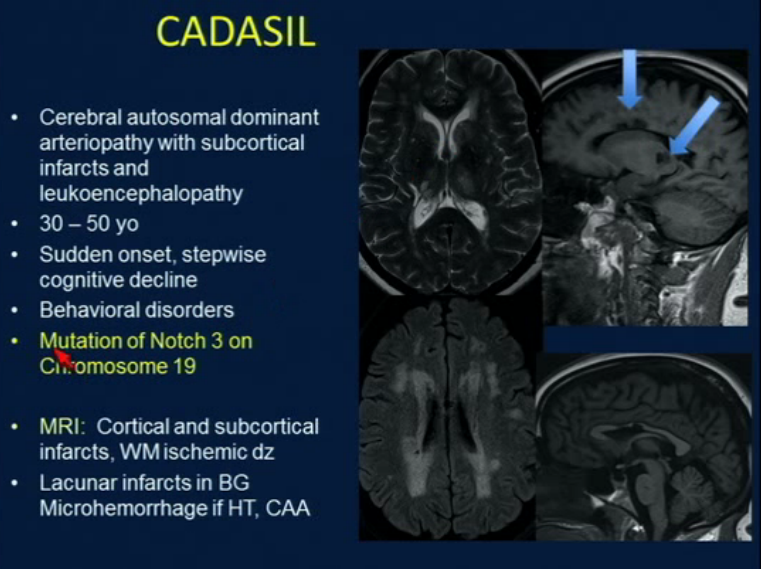 rsna: structural imaging for dementia