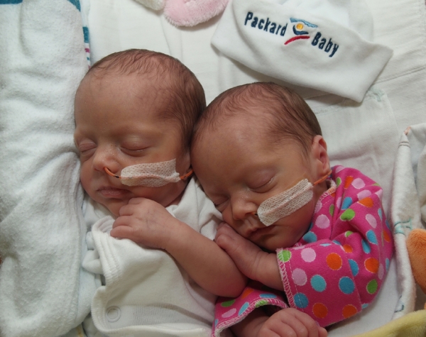 Monoamniotic Twins