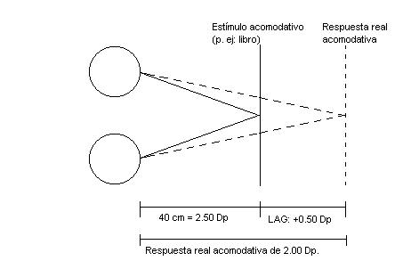 TECNOLOGÍA MEDICA OFTALMOLOGÍA: La acomodación