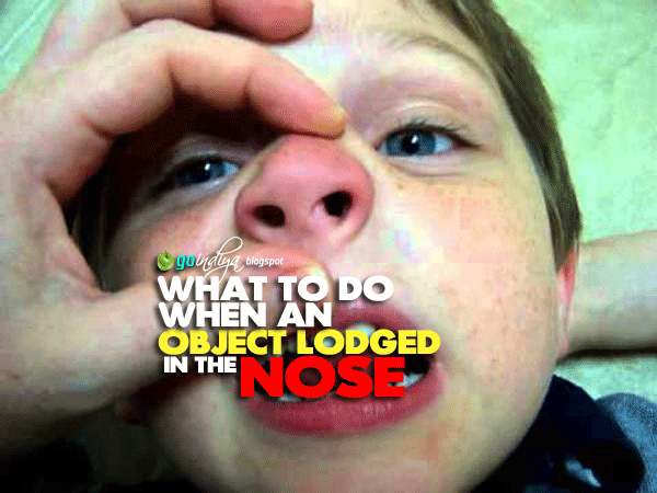 What to Do When an Object Lodged In the Nose - Natural Home Remedies ...
