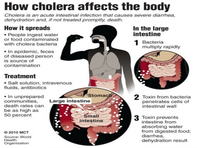 About Cholera Disease