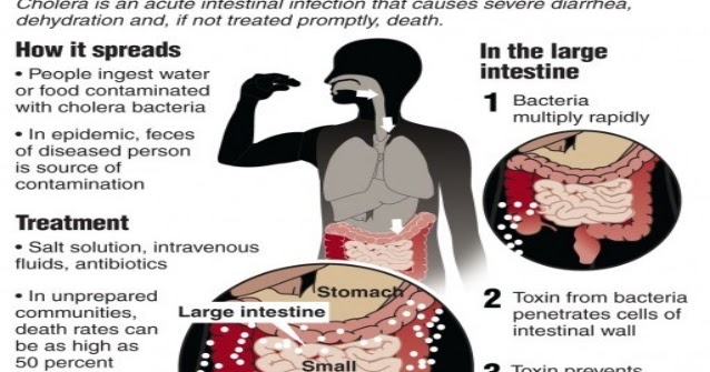 About Cholera Disease