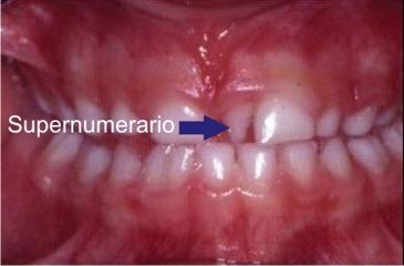 como hacer un bloc: SUPER NUMERARIOS