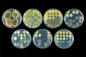 Pengamatan Terhadap Hasil Inokulasi dan Isolasi - Dunia Kimia