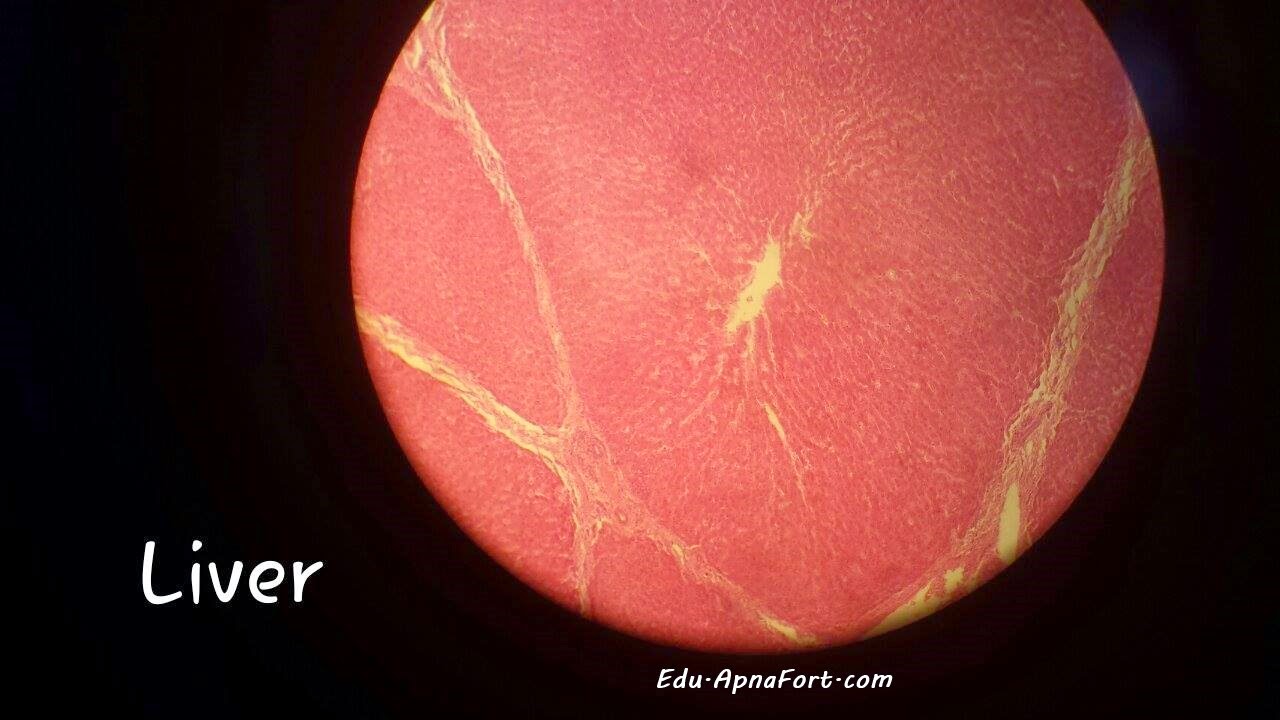 Educational Blog : Liver slides