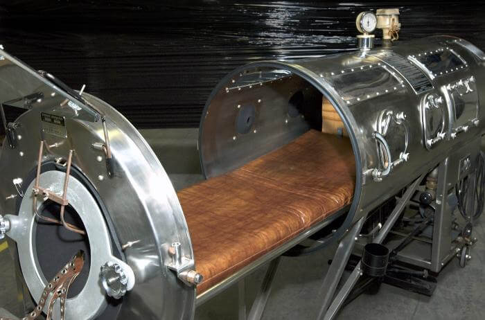 How the iron lung works: Poliomyelitis - HAFR