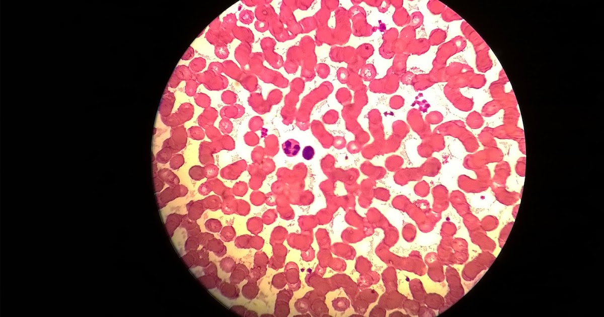 Cuaderno de prácticas de hematologia: Fórmula leucocitaria (01 de ...