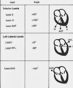 Health: Dasar - dasar EKG (Electrocardiogram)