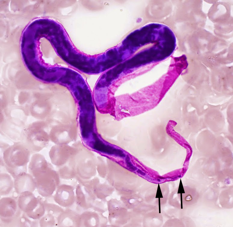 Brugia Malayi Microfilariae