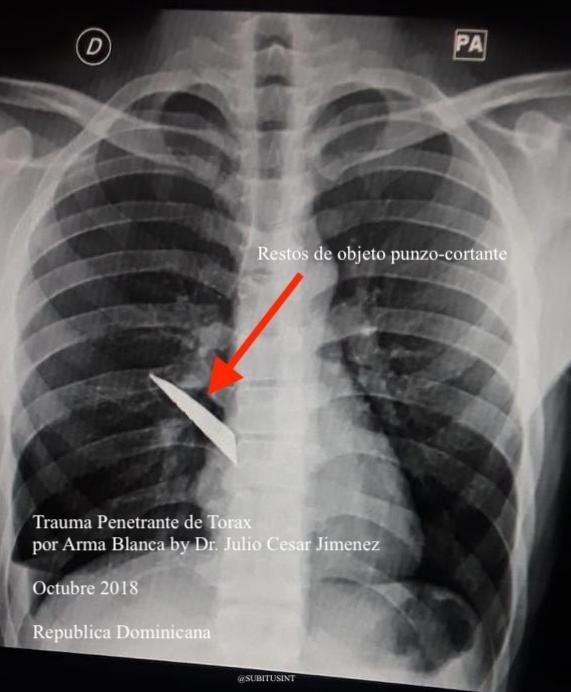 EMS SOLUTIONS INTERNATIONAL by @DrRamonReyesMD marca registrada: TRAUMA ...