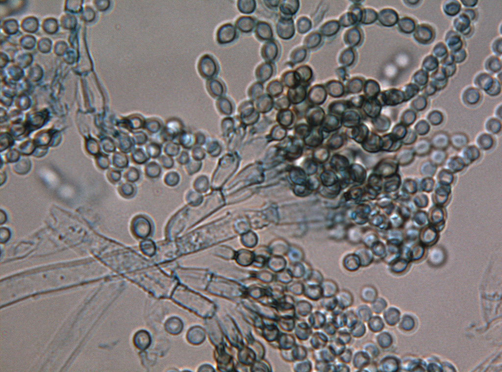 Fungi, Klasifikasi Fungi (Ascomycota) - Biologi Edukasi: Belajar Sains ...