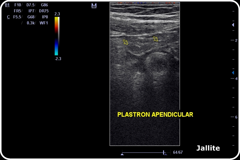 Plastron Apendicular