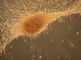 PASANDO PAGINA: ¿¿ que pasa en la muerte de celulas ??? Como se ...